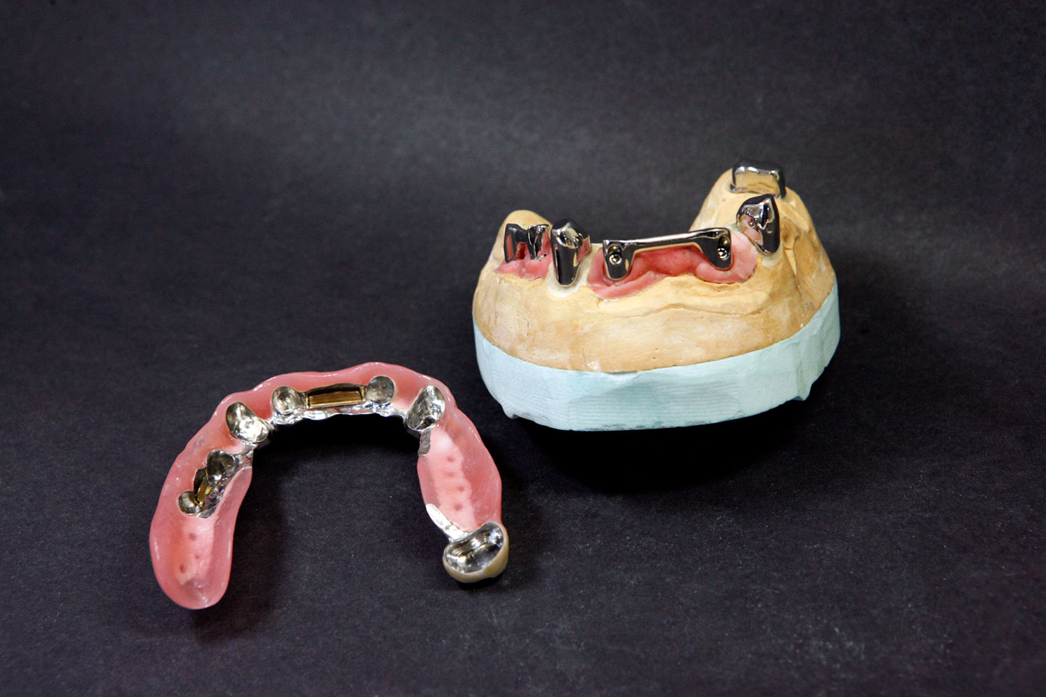 Kombinationsprothesen – Miro & Buntenbach