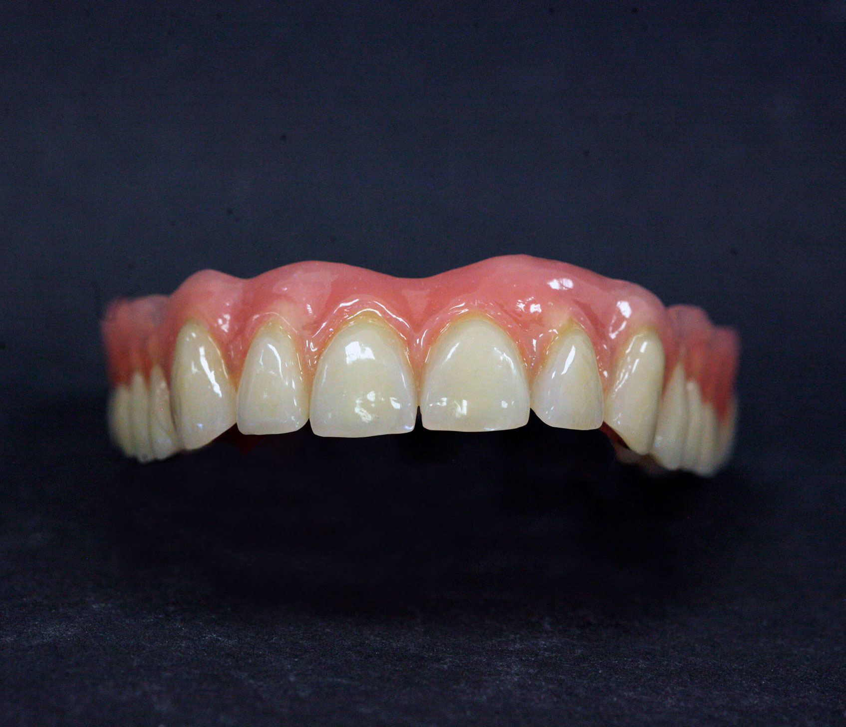 Implantologie – Miro & Buntenbach